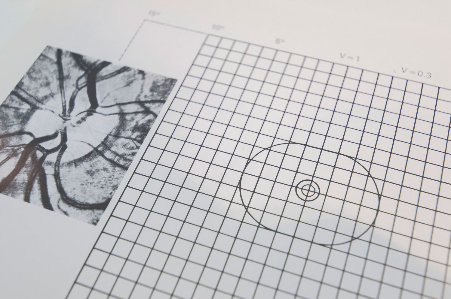 Rejilla de Amsler - Ópticas ClaraVisión